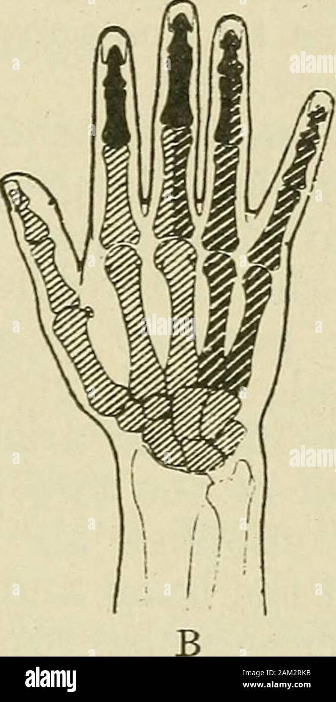 Medical and surgical therapy . A Fms. 59 and 60.—Nerve-supply of the ...