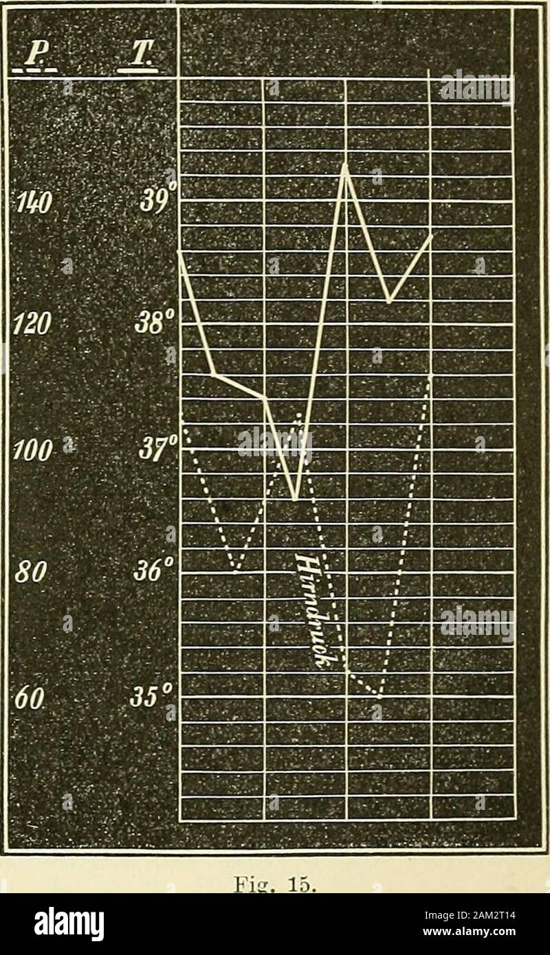 Pulsfrequenzen hi-res stock photography and images - Alamy