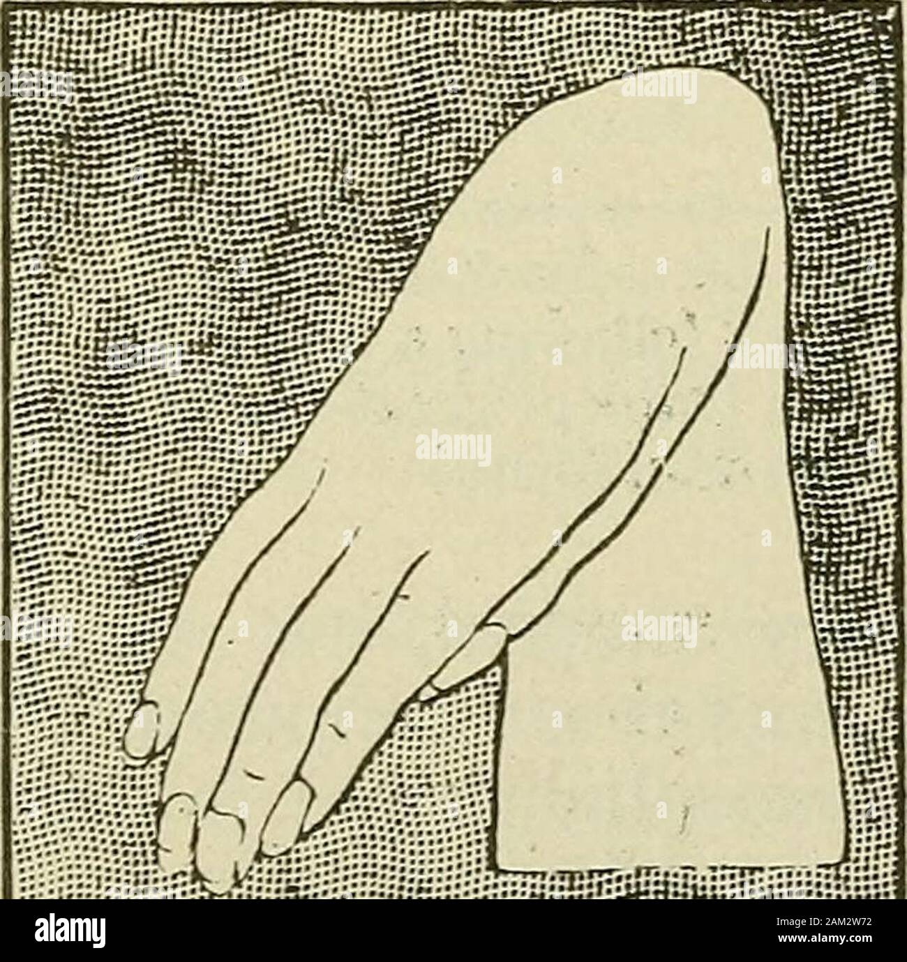 Finger flexion hi-res stock photography and images - Alamy