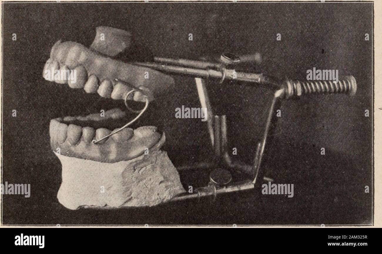 Three plate method hi-res stock photography and images - Alamy