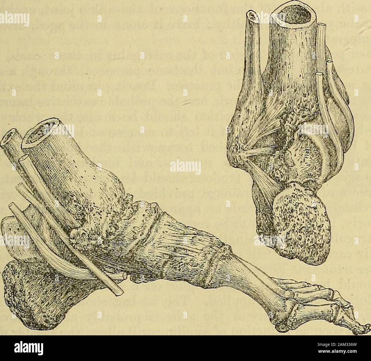 Malleoli hi-res stock photography and images - Alamy