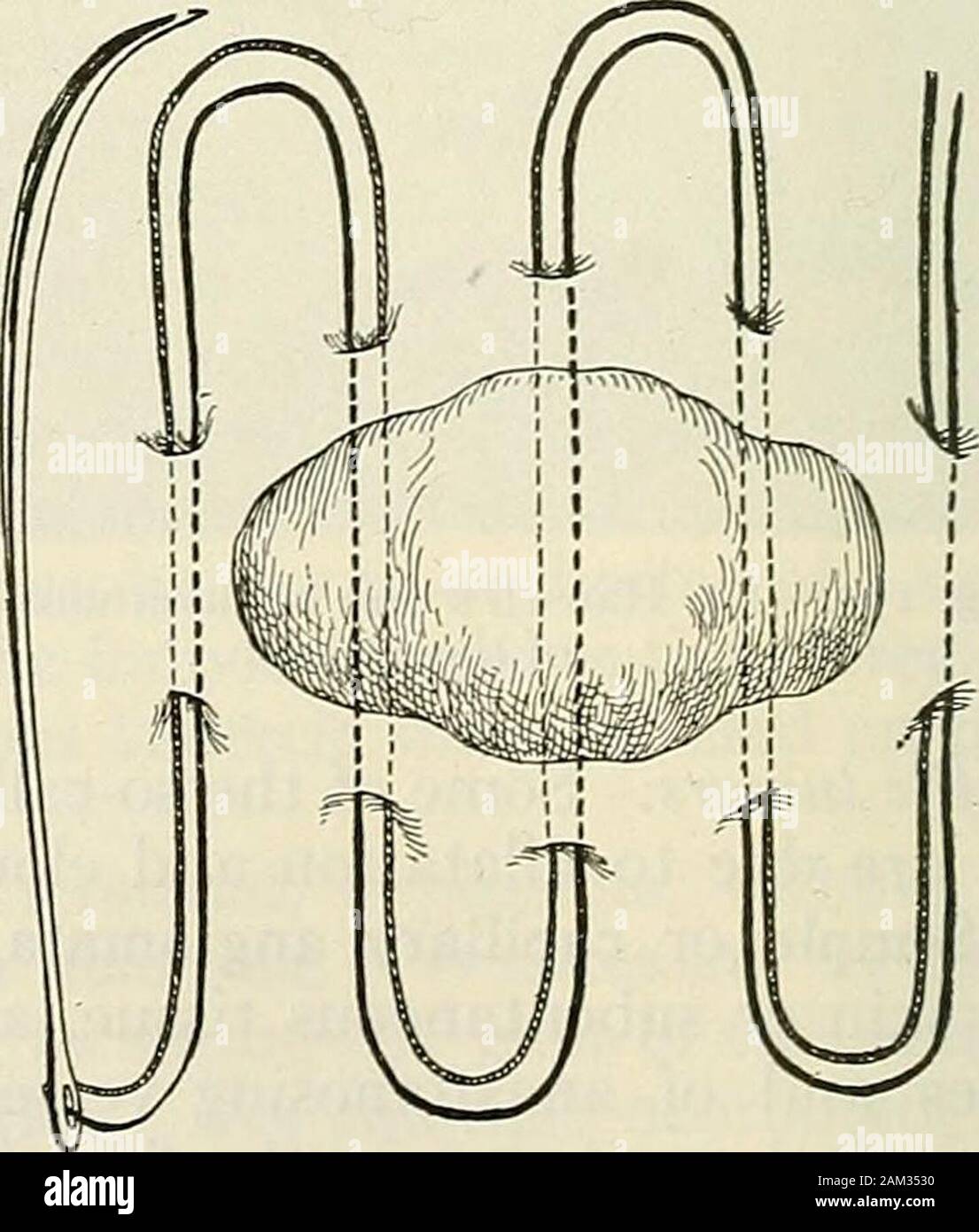 Capillary method hi-res stock photography and images - Alamy