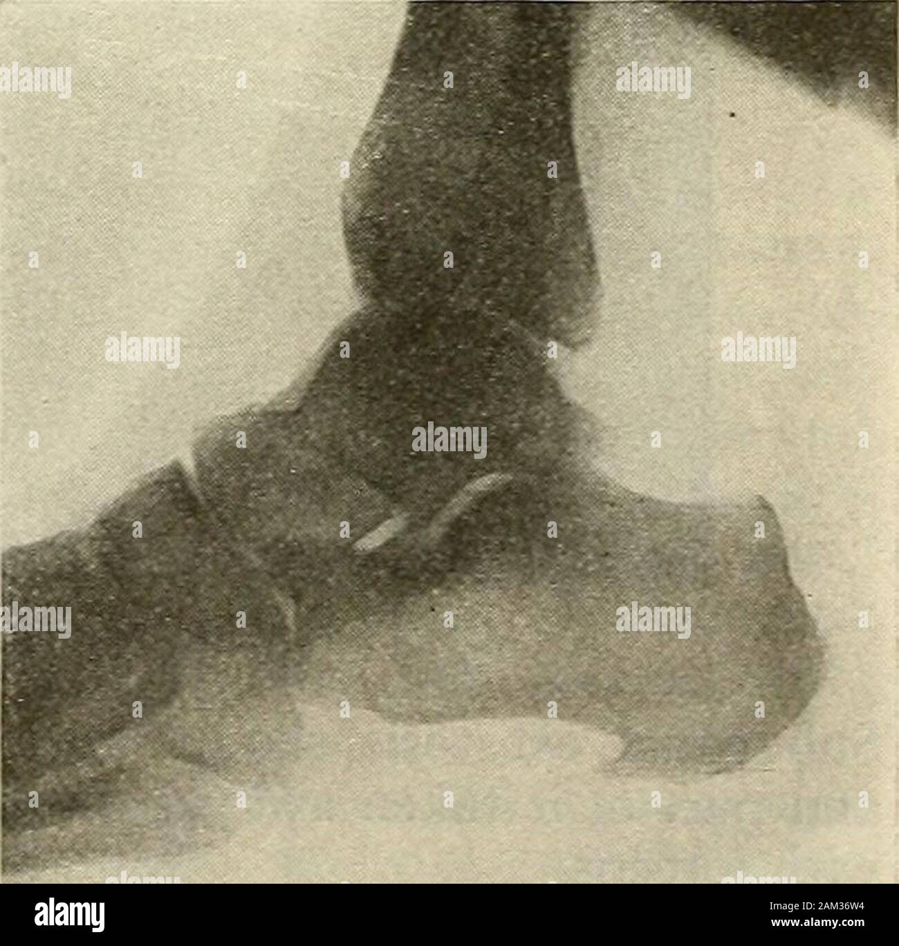 Modern surgery, general and operative . es, are angled, nodular,fiirm ...