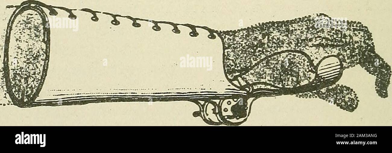 Medical and surgical therapy . Fig. 30.—Applicance of Henry Meige ...