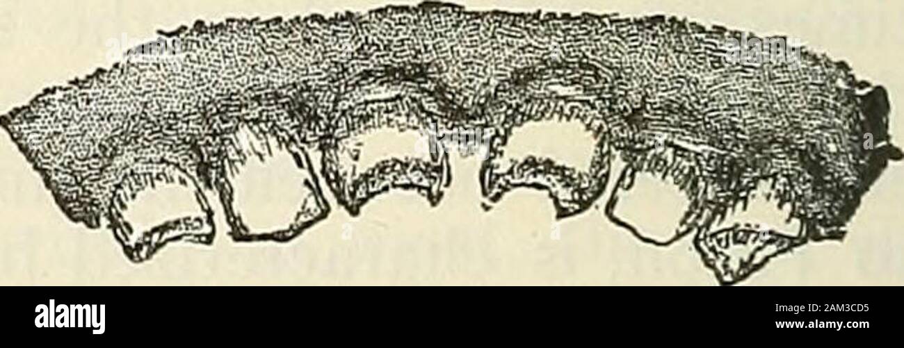 Defective teeth hi-res stock photography and images - Alamy