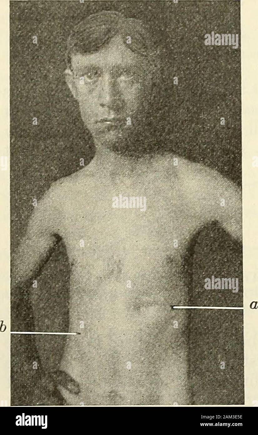 Modern surgery, general and operative . y are more humane thanwere the ...