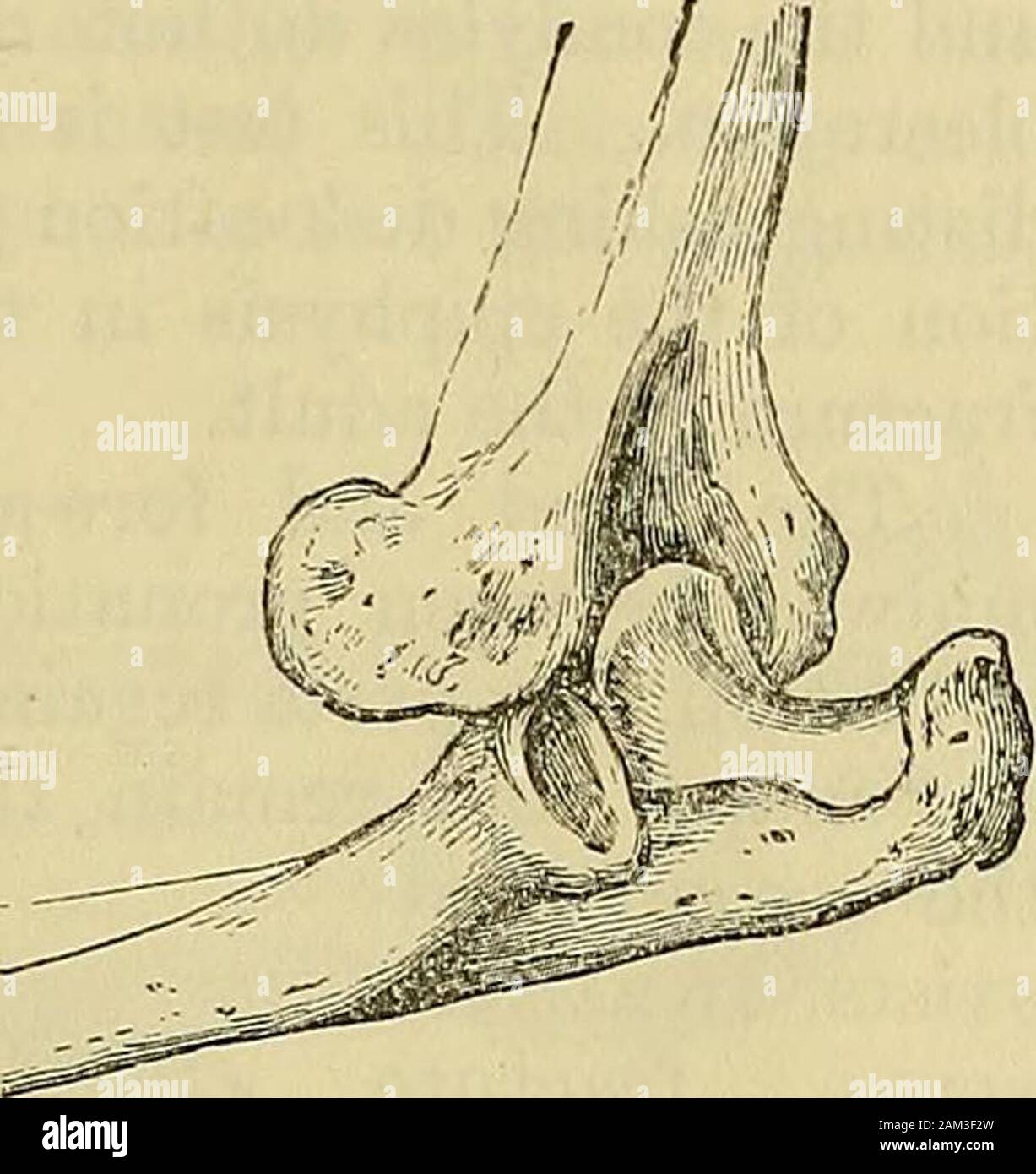 A system of surgery . lna back-wards, (2) outwards, (3) inwards, (4) or ...