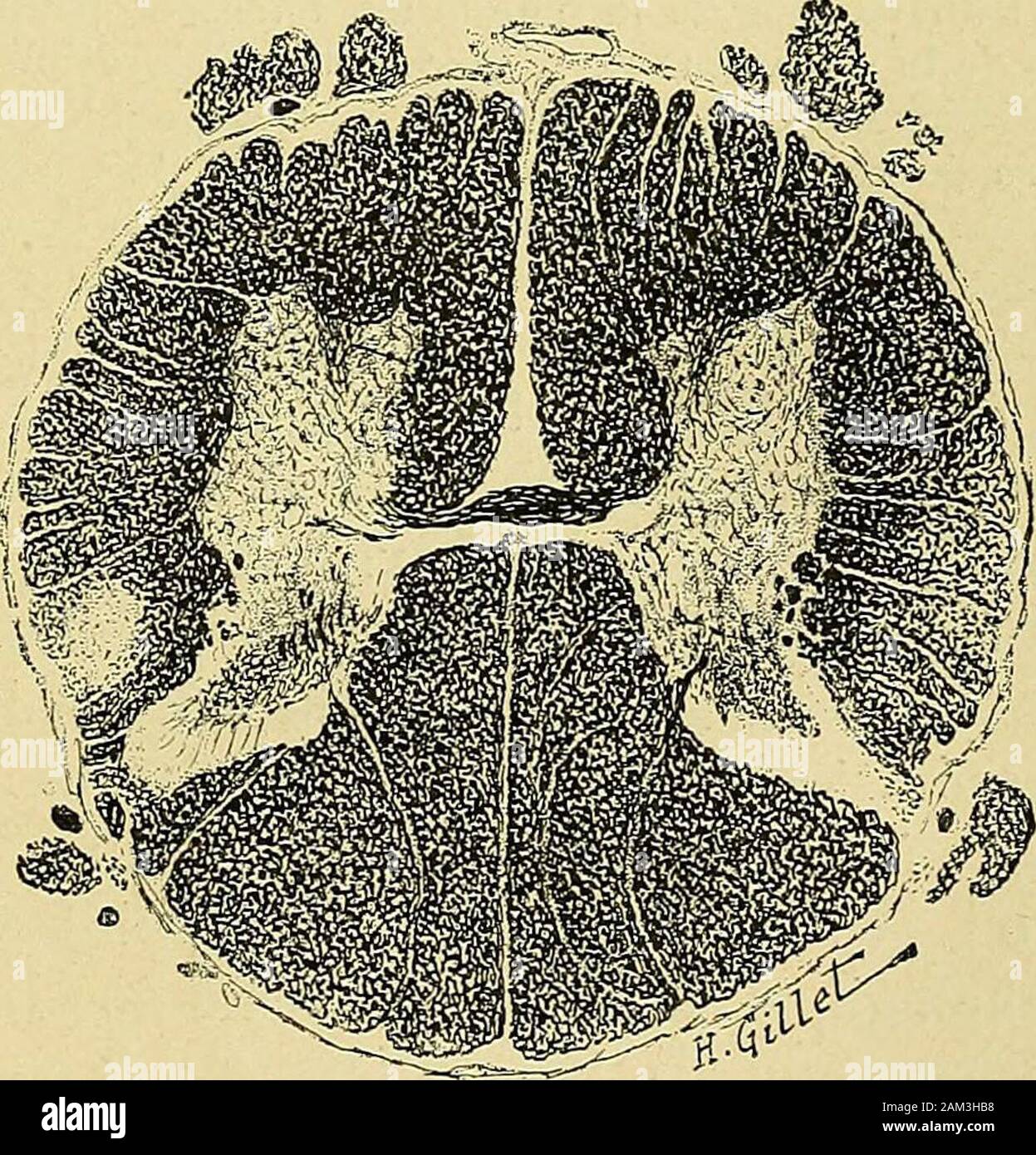 Renflement de la moelle epiniere hi-res stock photography and images ...