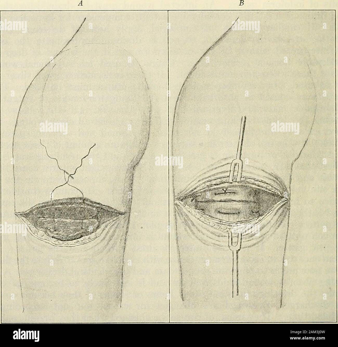 Modern surgery, general and operative . d with Biers treatment com ...