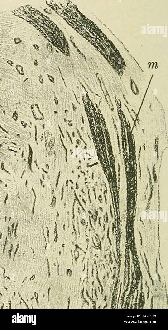 Medical and surgical therapy . vJ V i-S >. ;? ^ , ^- Fig. 9.—Lateral ...