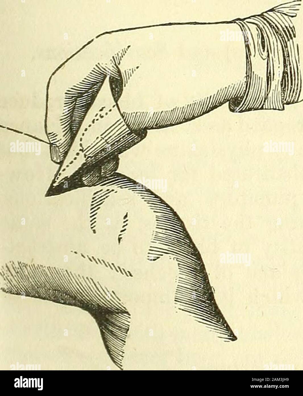 Leech mouth hi-res stock photography and images - Alamy