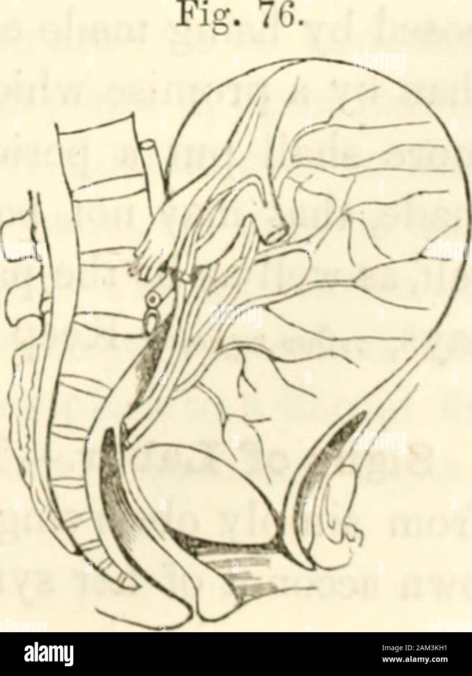 Cervix labor hi-res stock photography and images - Alamy
