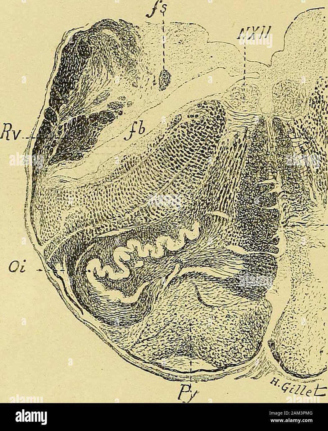 Traité des maladies de la moelle épinière . é de la substance grise ...