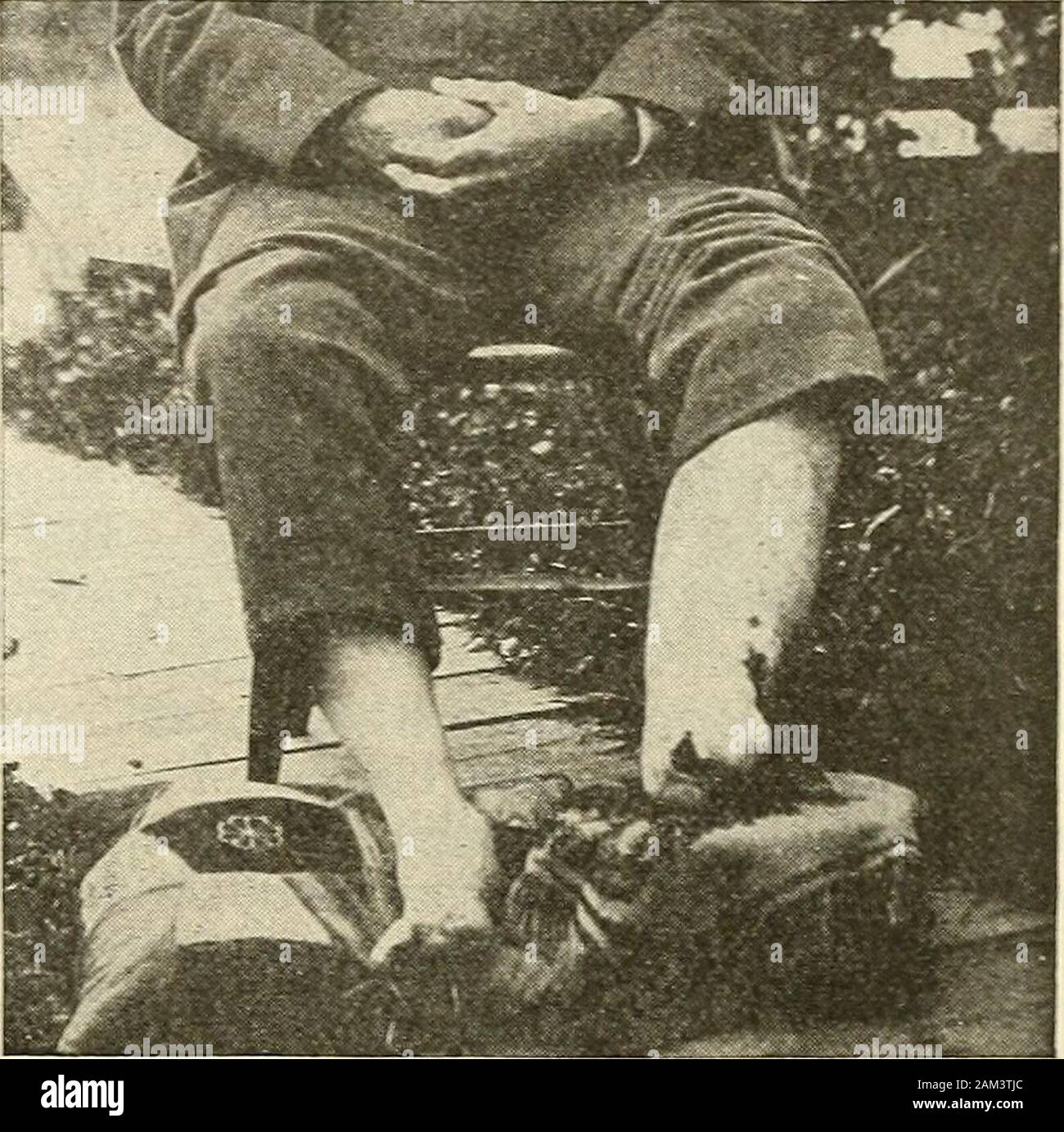 Septic foot hi-res stock photography and images - Alamy