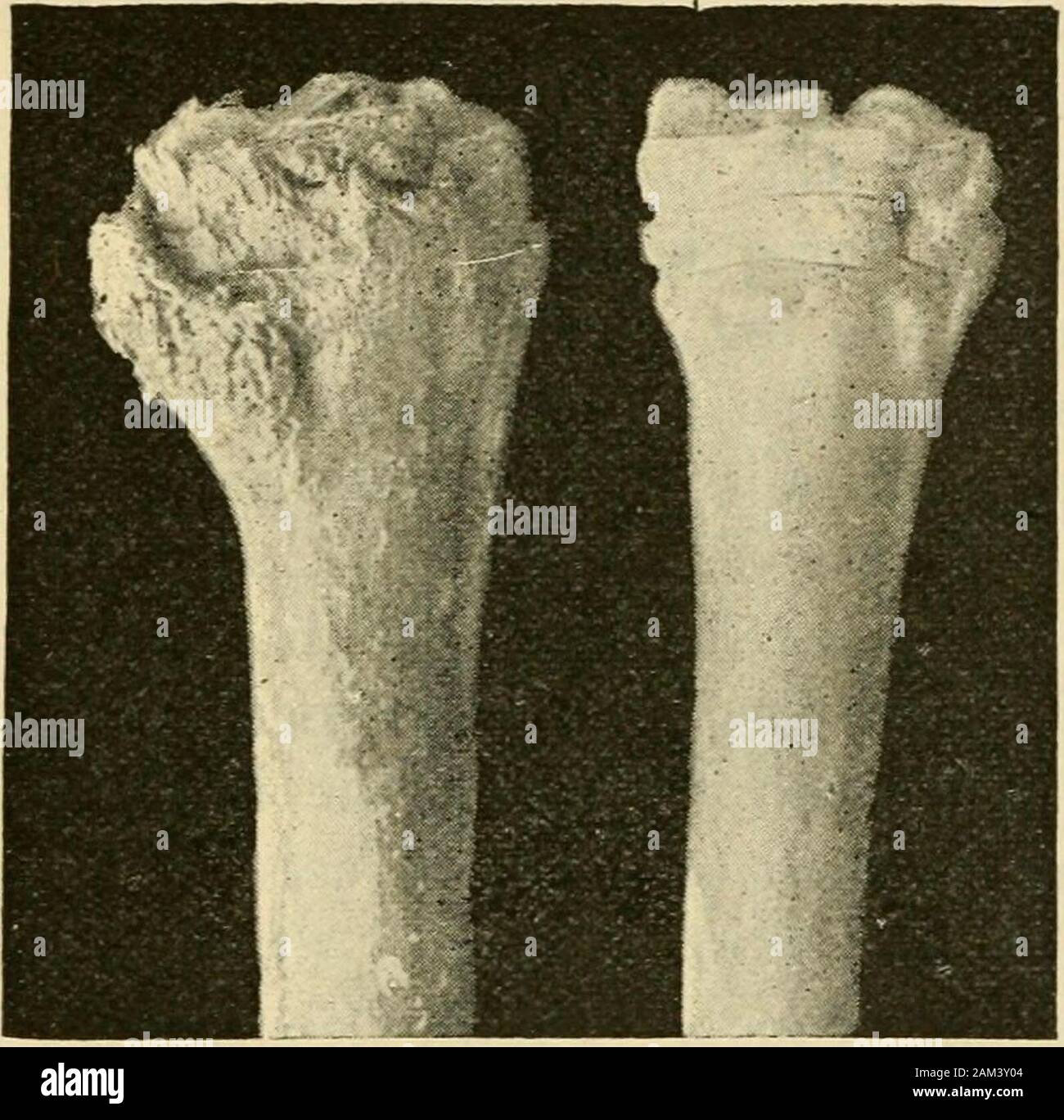 Bone spavin hi-res stock photography and images - Alamy