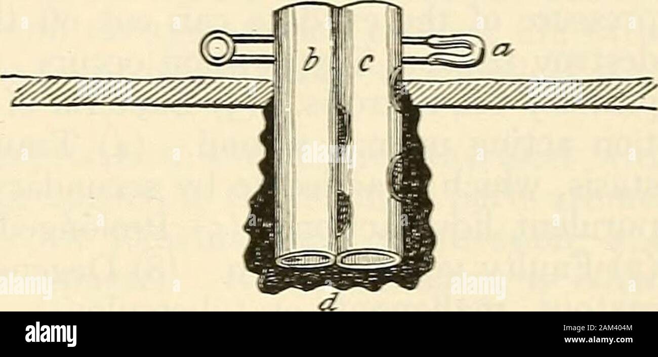 Modern surgery, general and operative . Tio-itis, Purulent Peritonitis ...