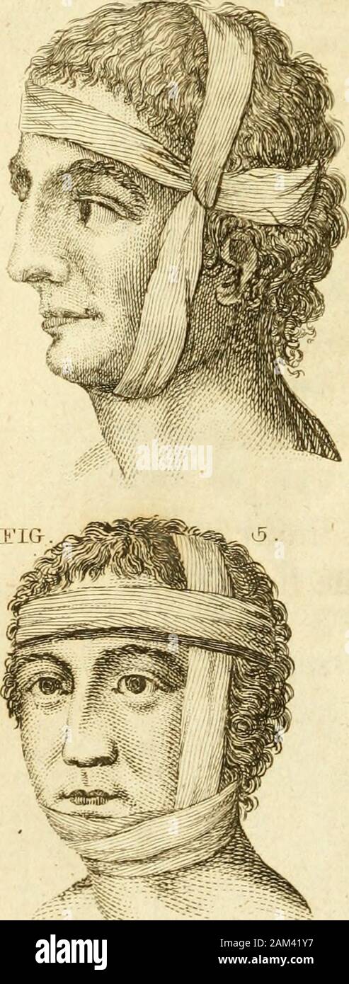 A system of surgery / Benjamin Bell . FIG.3. FIG-. 4 Stock Photo - Alamy