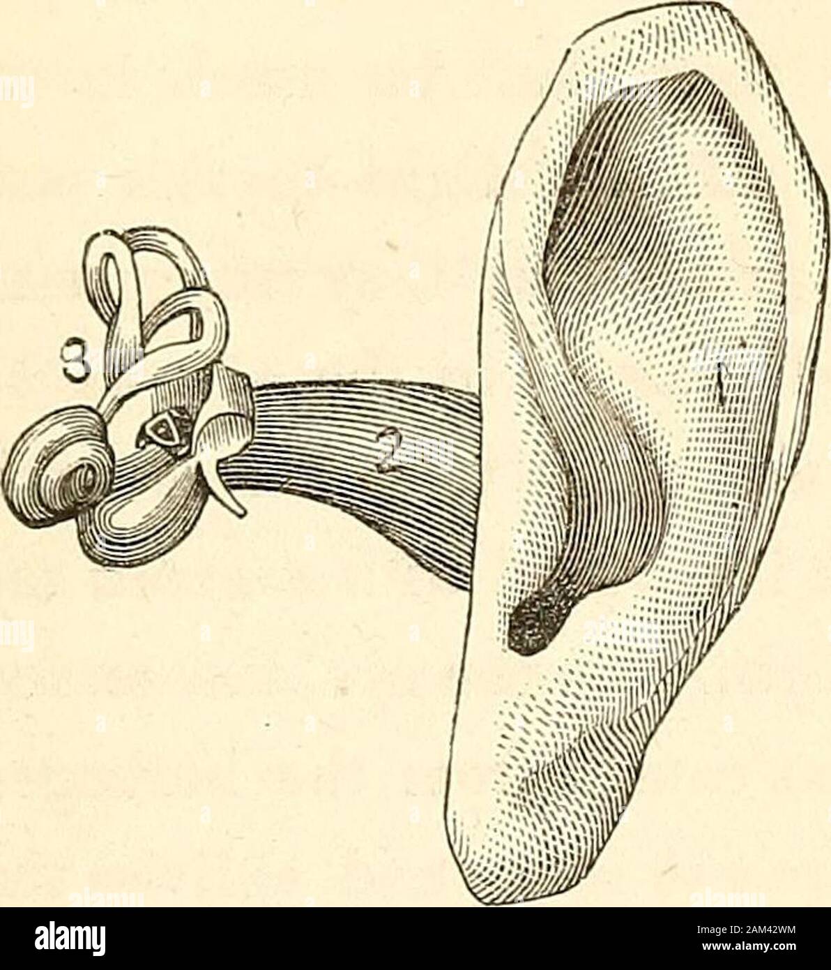 Sight and hearing, how preserved, and how lost . use a series of plain ...