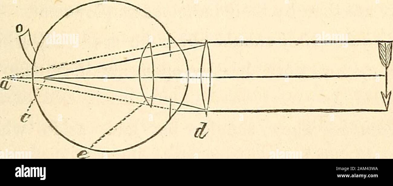 Interposition Example