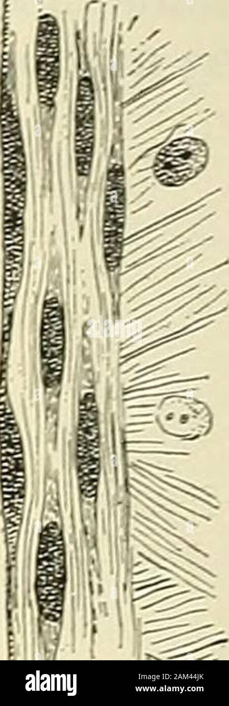 Granulation tissue wound hi-res stock photography and images - Alamy