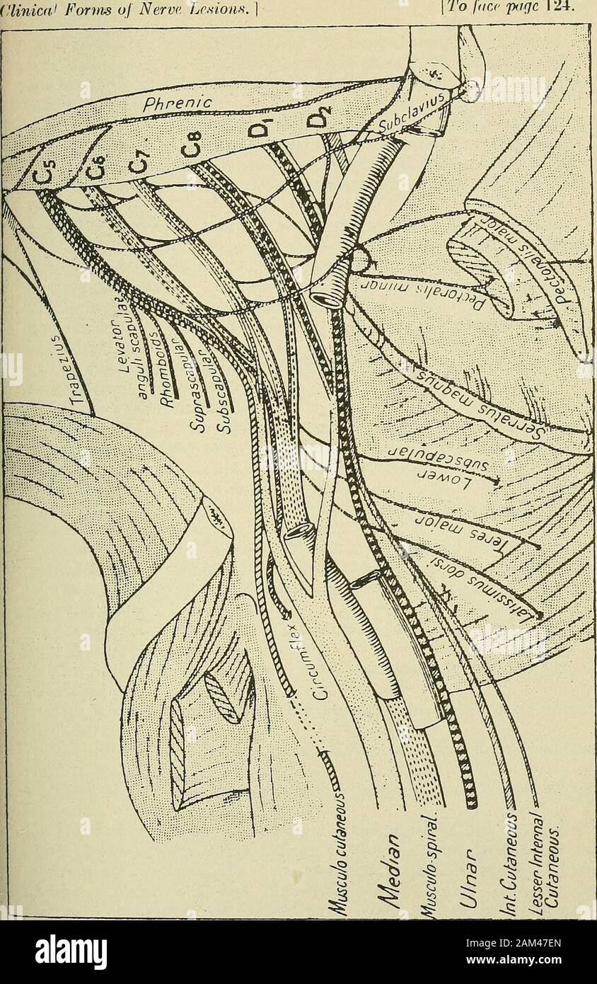 Lower Subscapular Nerve
