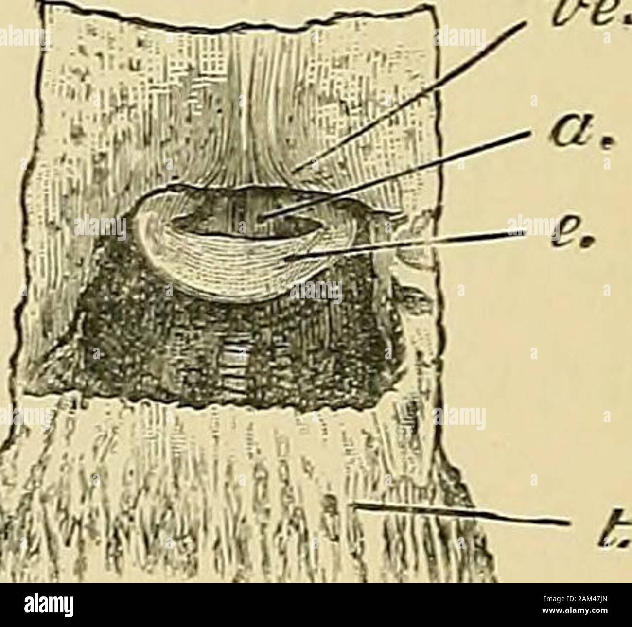 On stertor, apoplexy, and the management of the apoplectic state . /ra ...