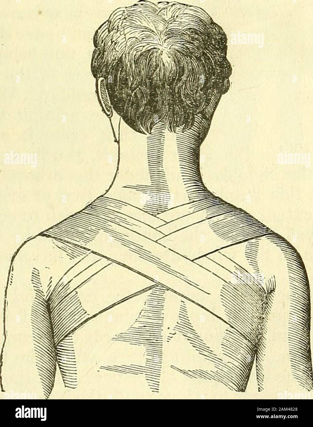 Inguinal region hi-res stock photography and images - Alamy