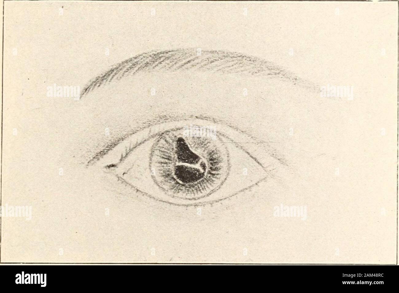 Dislocation lens hi-res stock photography and images - Alamy