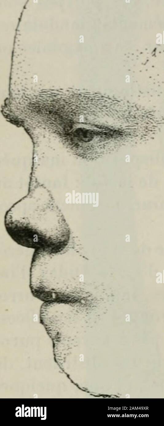 Nasale muqueuse hi-res stock photography and images - Alamy