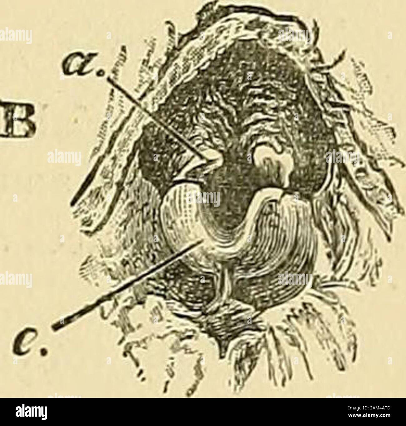 On stertor, apoplexy, and the management of the apoplectic state . Fig ...