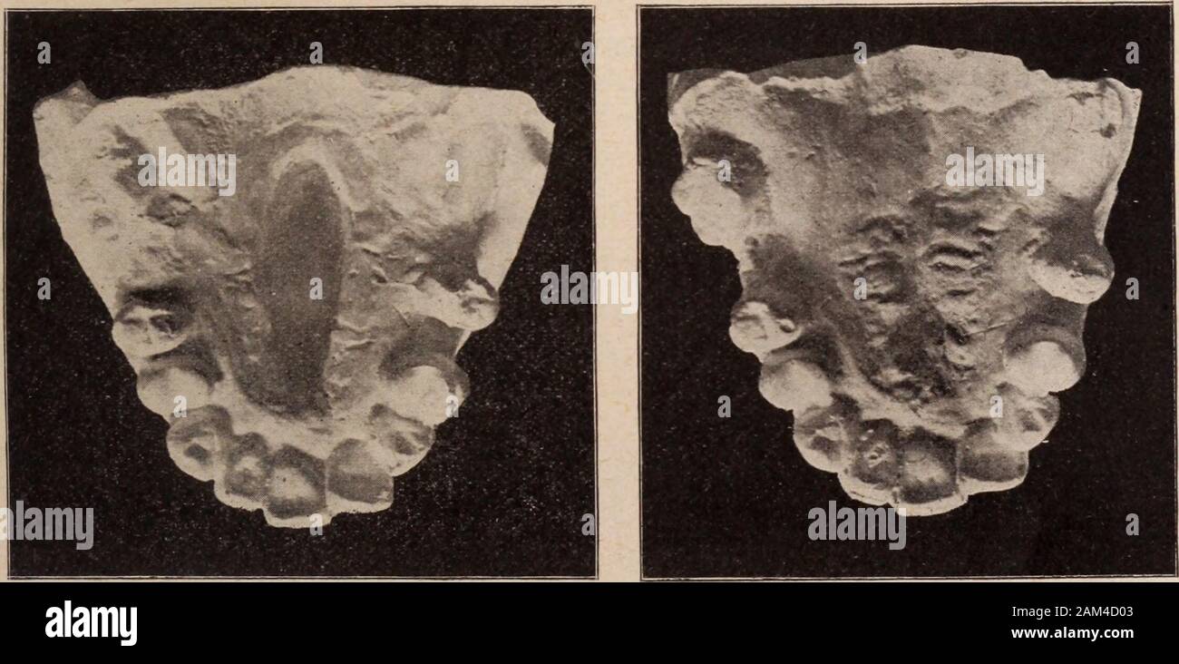 Interstate medical journal . ection of muscles where necessary to allow ...