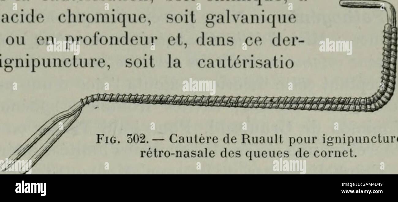 Traité de chirurgie . uqueuse nasale, pharyngite granuleuse ...