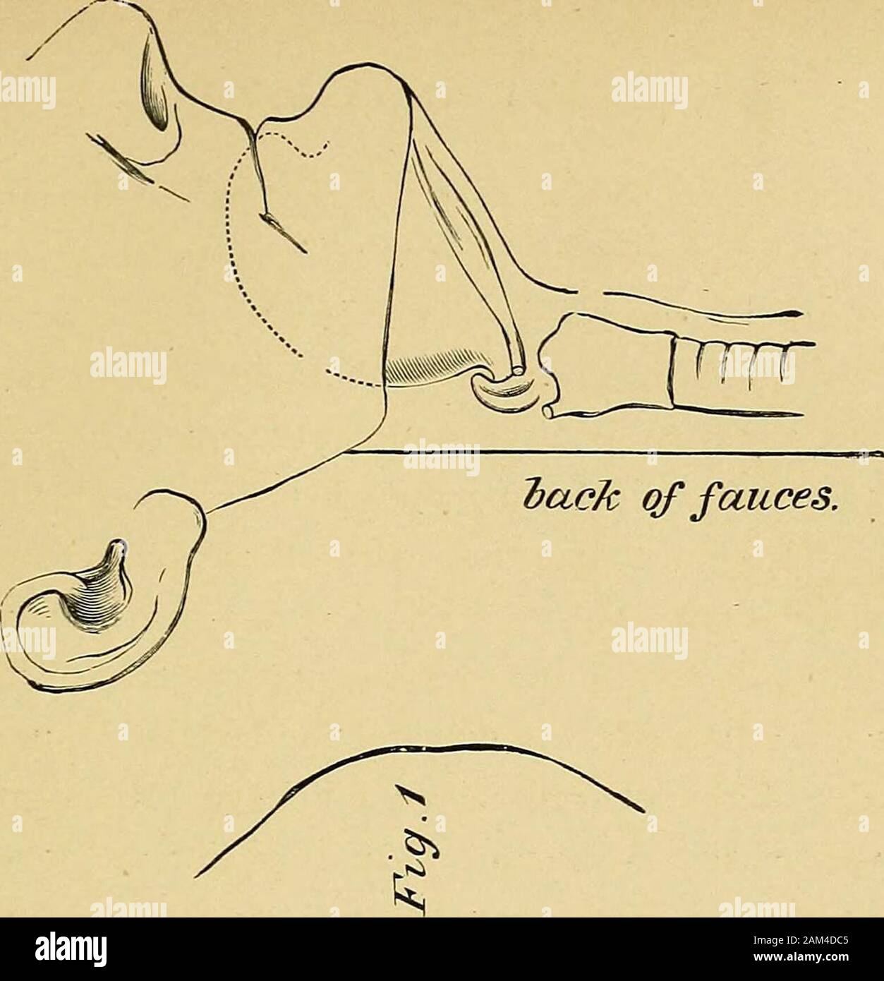 Spinalcolumn hi-res stock photography and images - Alamy