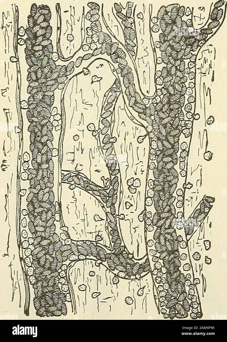 Lividity hi-res stock photography and images - Alamy