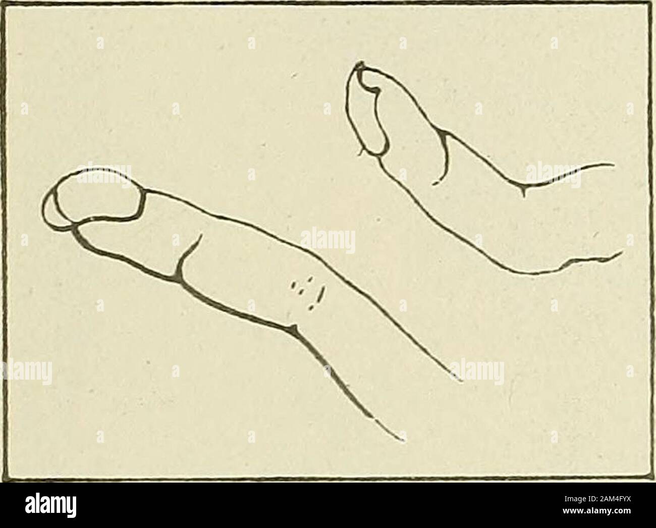 Medical and surgical therapy . nd more creased and wrinkledon the palm ...