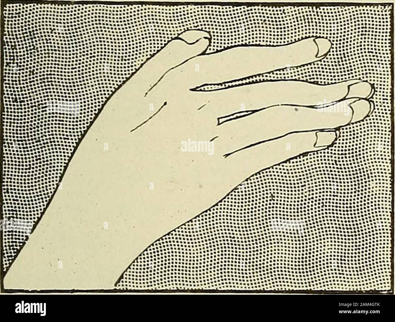 Diminished reflexes hi-res stock photography and images - Alamy