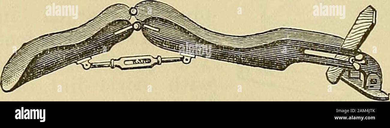 A system of surgery . toes point up and out in the position of rest; or ...