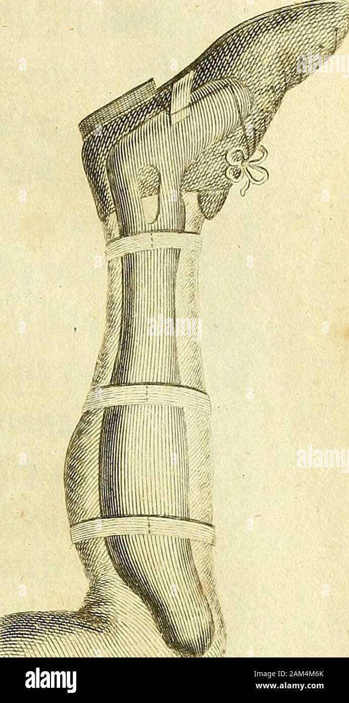 A system of surgery / Benjamin Bell . Ere-. 4 Stock Photo - Alamy