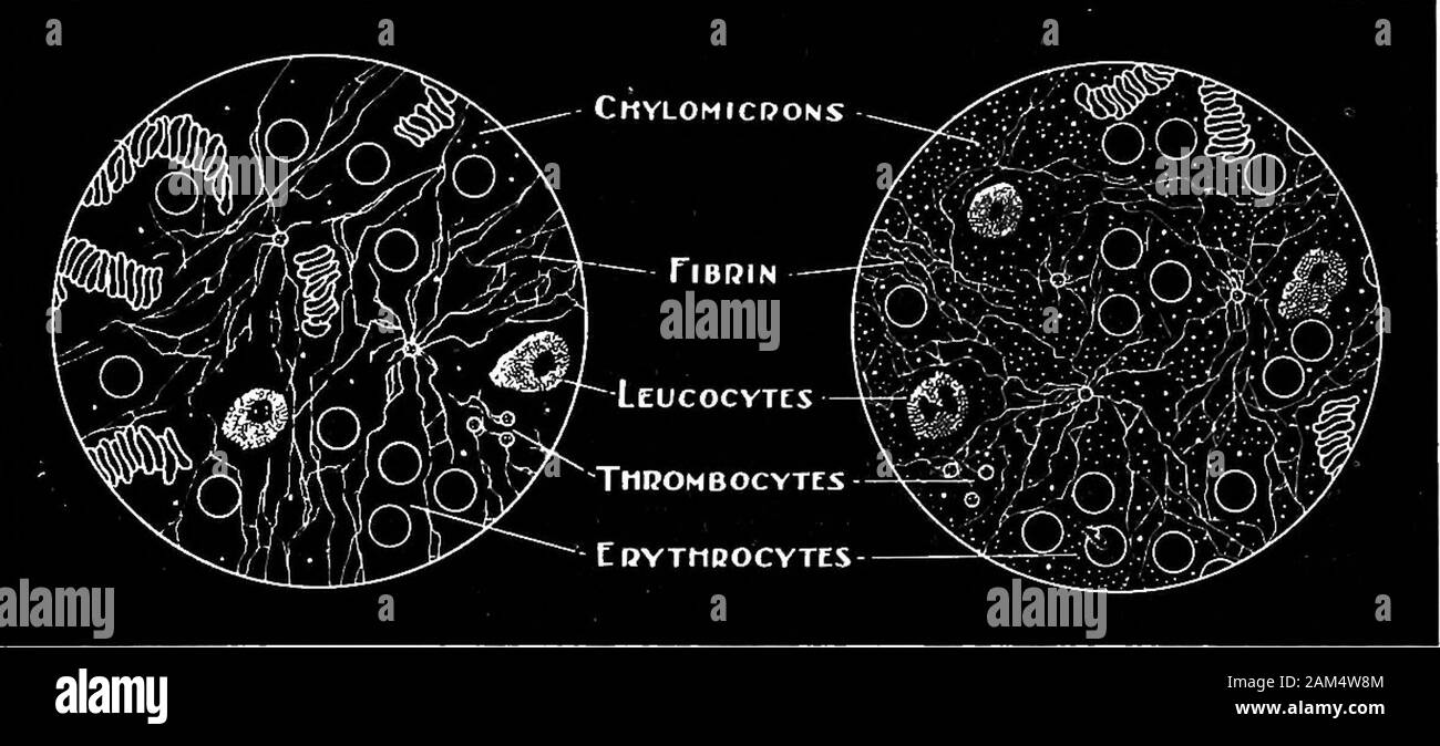 Diluting blood hi-res stock photography and images - Alamy