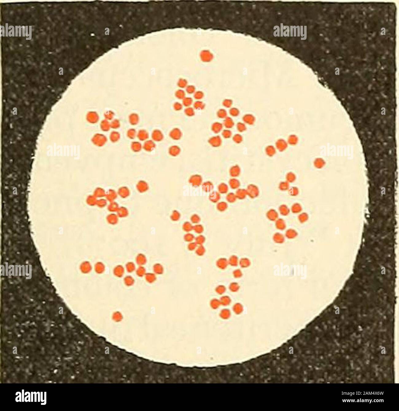 Staphylococcus epidermidis hi-res stock photography and images - Alamy