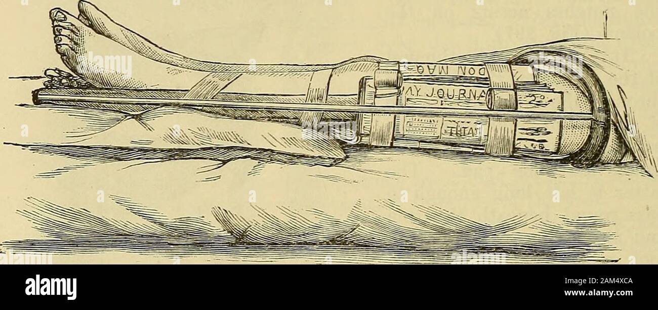 Perineal body hi-res stock photography and images - Alamy