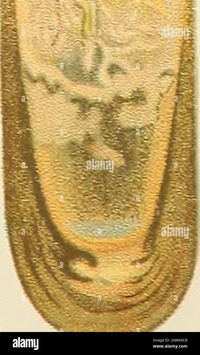 Boil carbuncle hi-res stock photography and images - Alamy