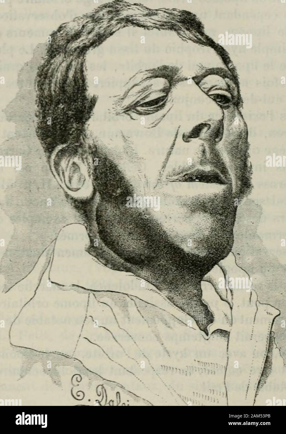 Traité de chirurgie . t. La symétrie ou la bilatéralitéest en efTet un ...