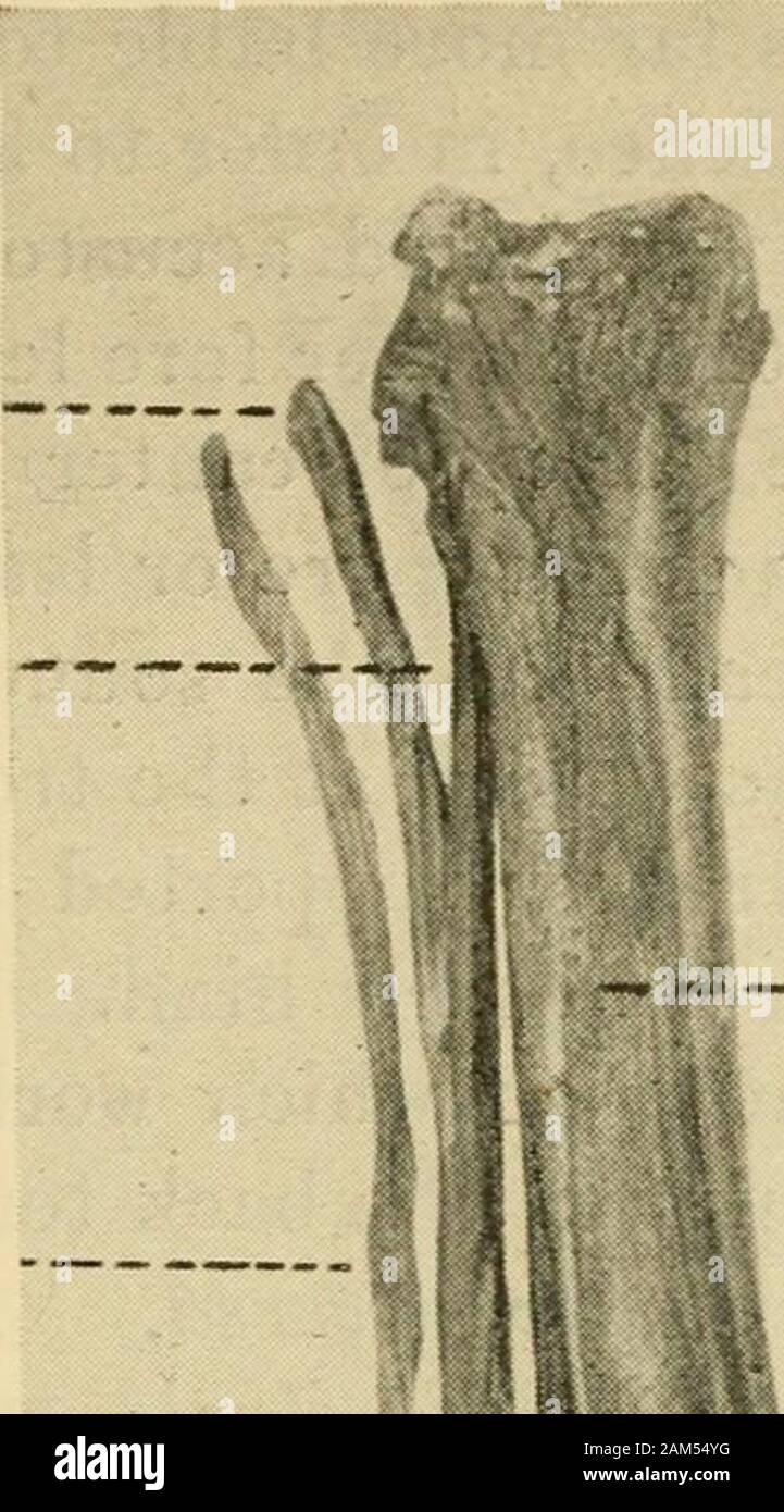 Long furlong hi-res stock photography and images - Alamy