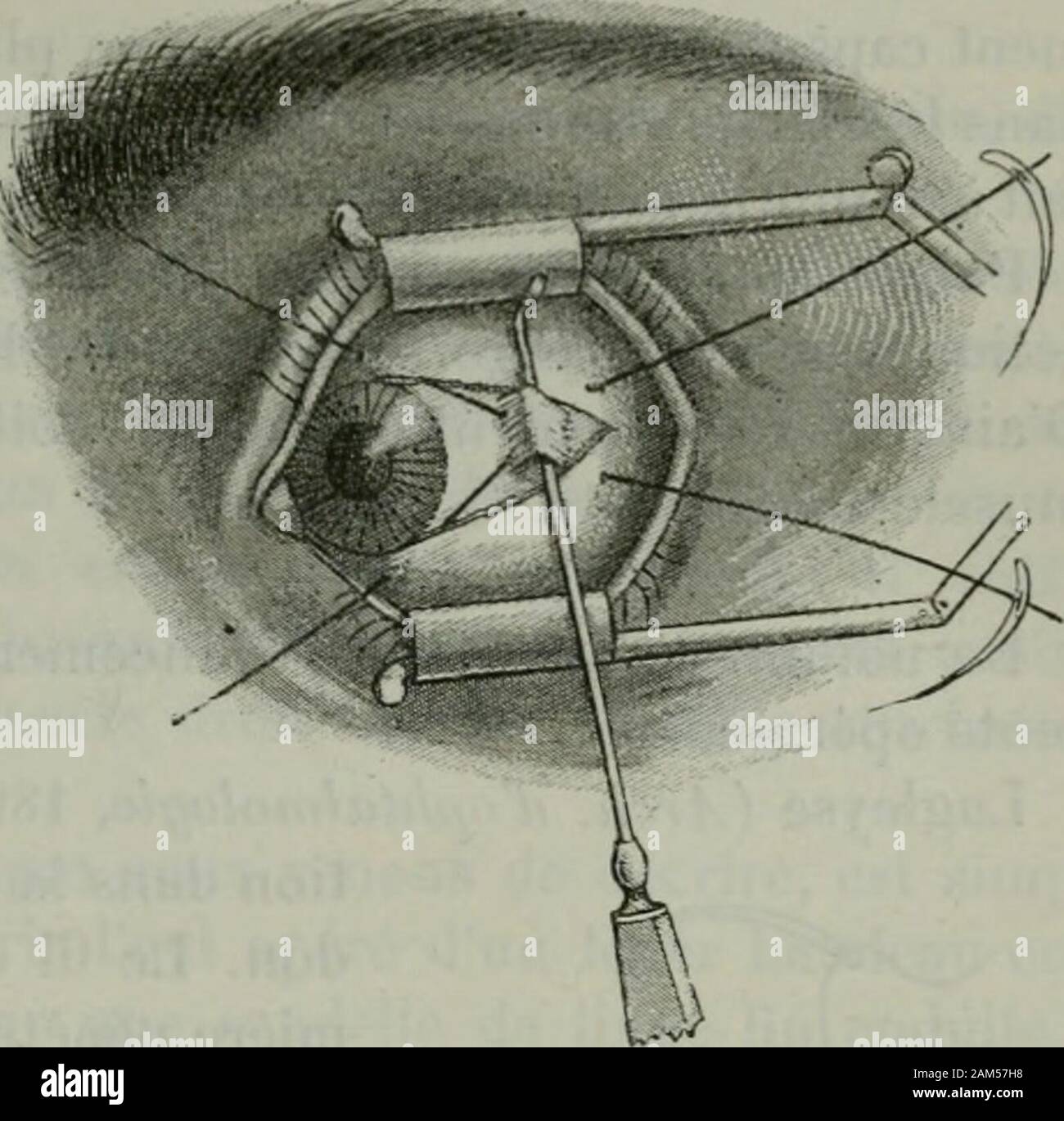 Point de suture chirurgie hi-res stock photography and images - Alamy