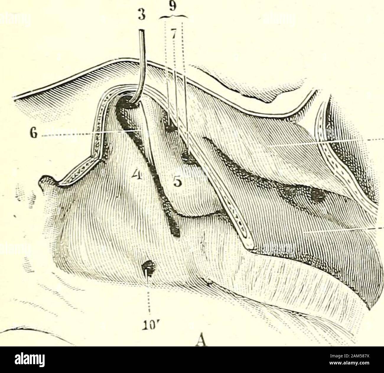 Squelette d'anatomie hi-res stock photography and images - Alamy