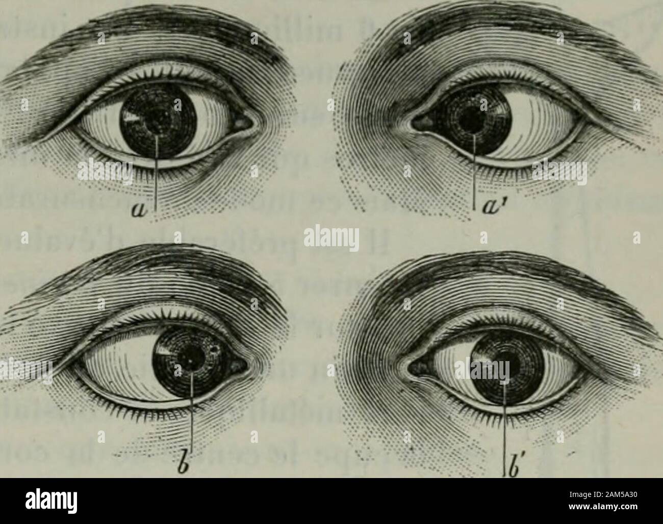 Lacement hi-res stock photography and images - Alamy