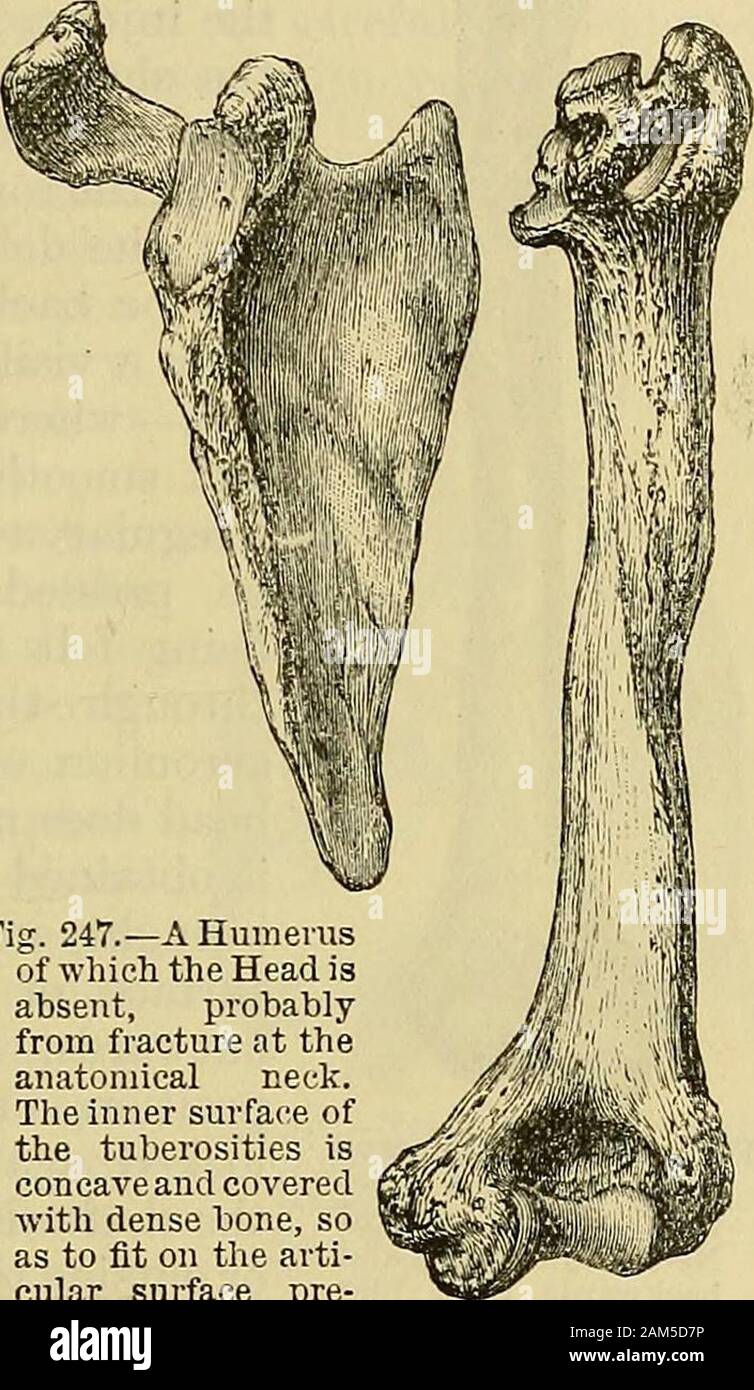 Pyramidal bone hi-res stock photography and images - Alamy