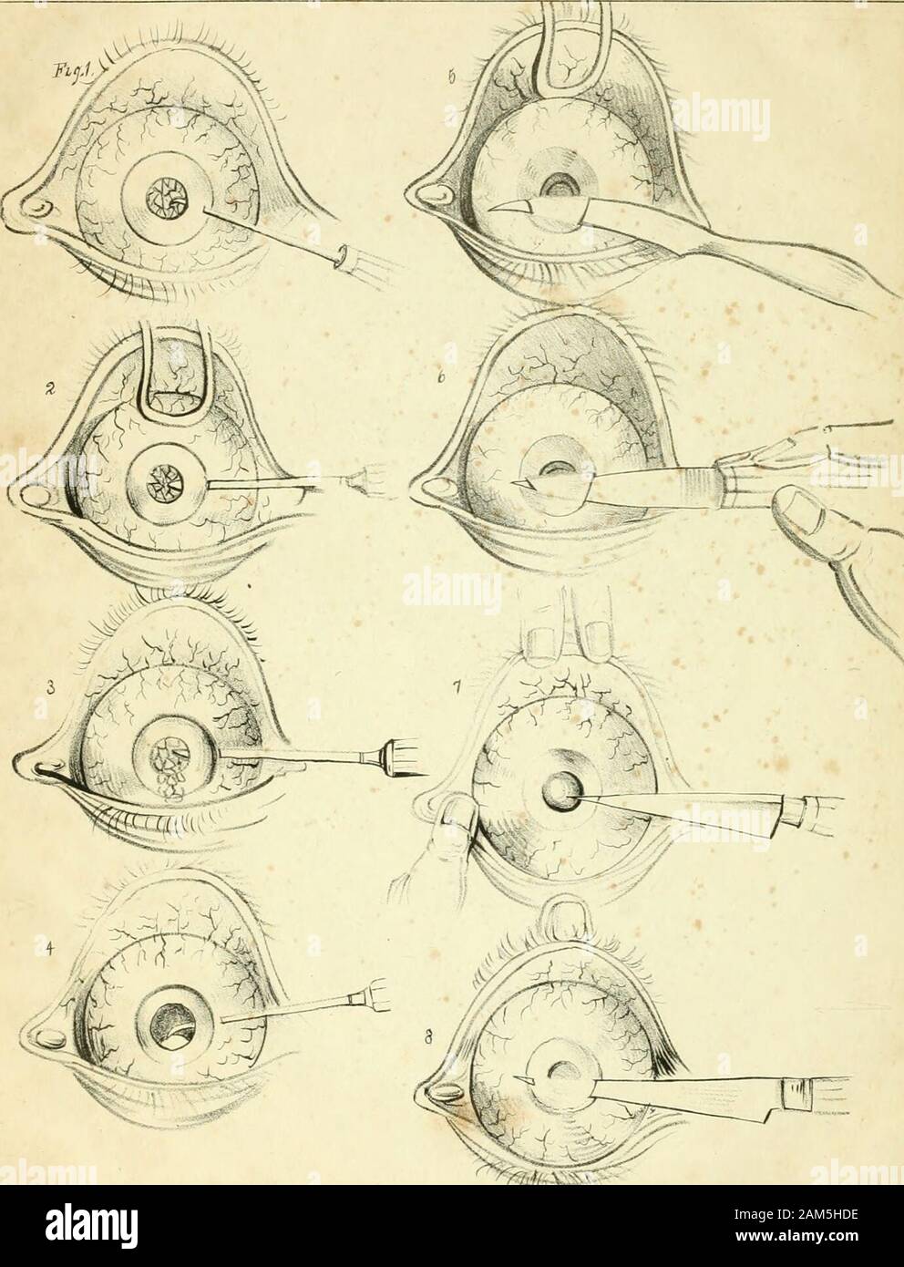 A condensation of matter upon the anatomy, surgical operations and ...