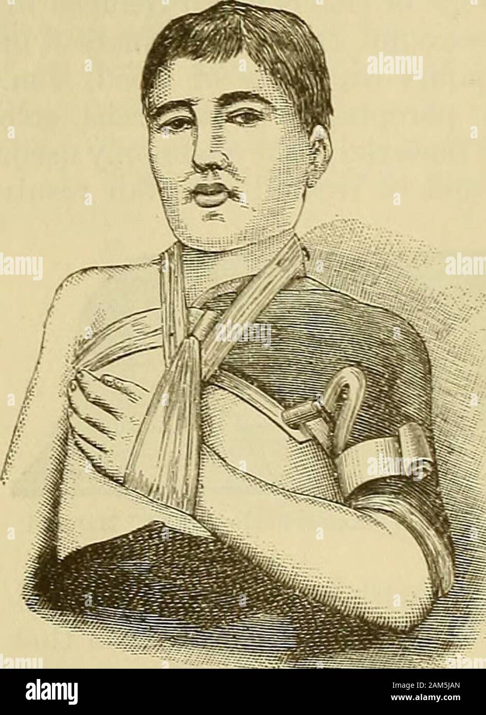 Rigid splints hi-res stock photography and images - Alamy